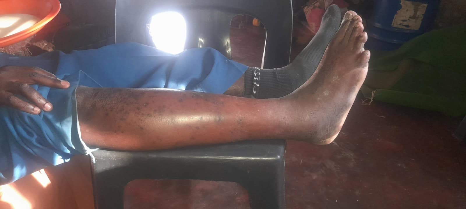 Fourways cleaner struggles to raise funds for ailing father | Fourways ...