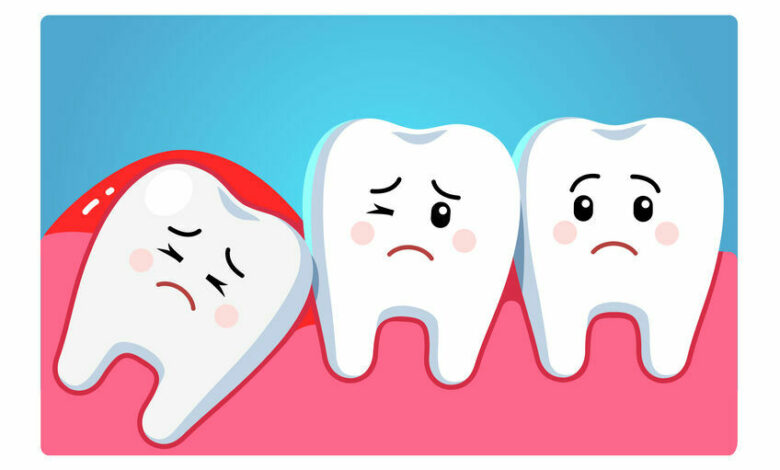 Help: My child has an abscessed tooth! - Lowvelder