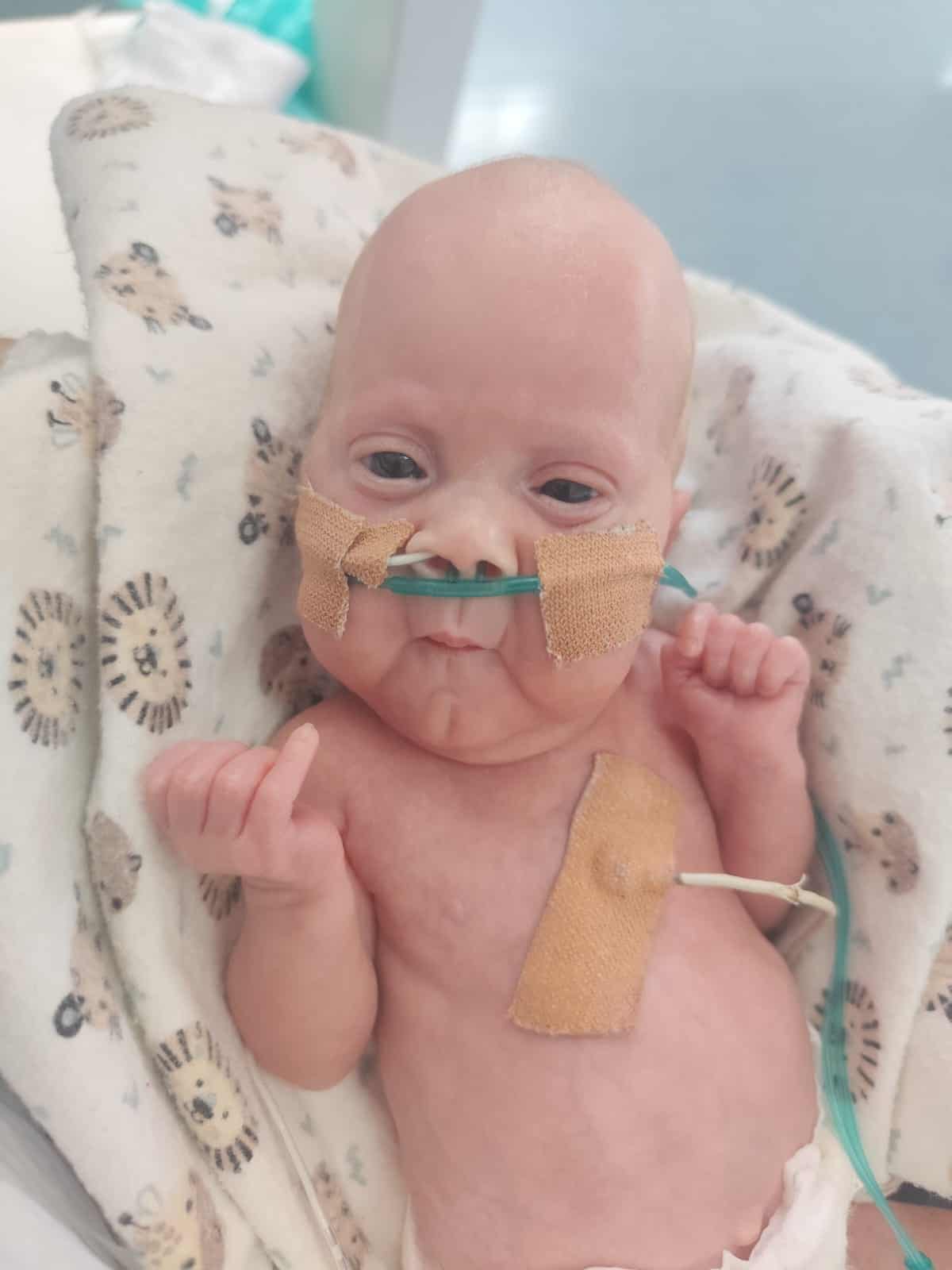 Bill over R700 000 for miracle baby Ayden | Middelburg Observer