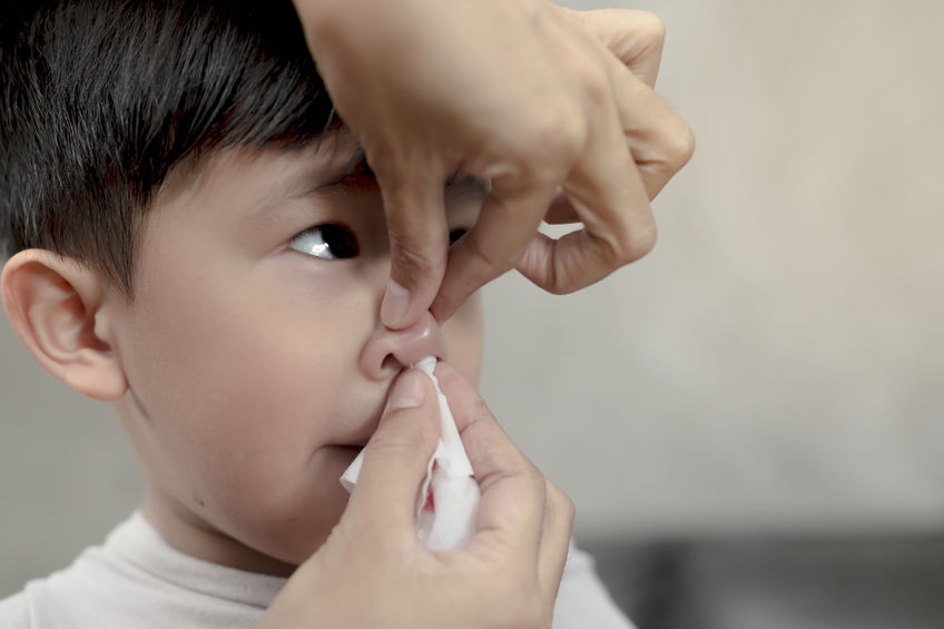 All about nosebleeds in children | Network News