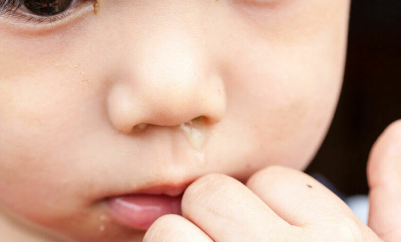 Flu symptoms in babies: When to see a doctor | Network News