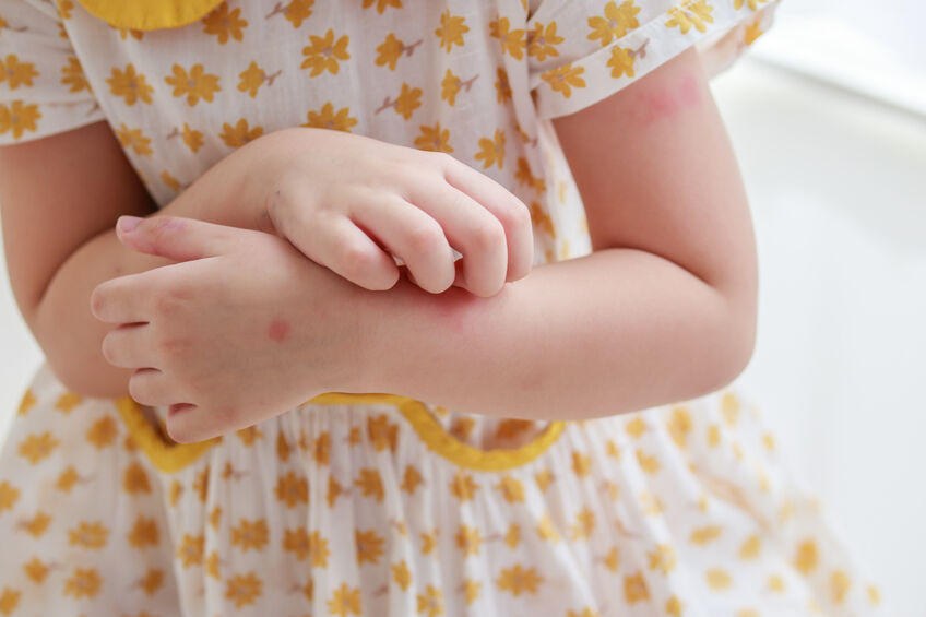 How to treat your child's skin rash | Network News