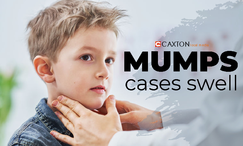 SA mumps outbreak: What should you look out for? - LNN - Network News