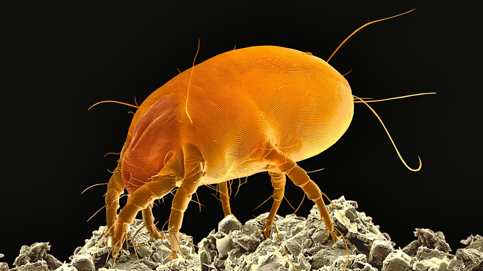 FREAKY FRIDAY: 10 Disgusting things that live in your bed | Network News