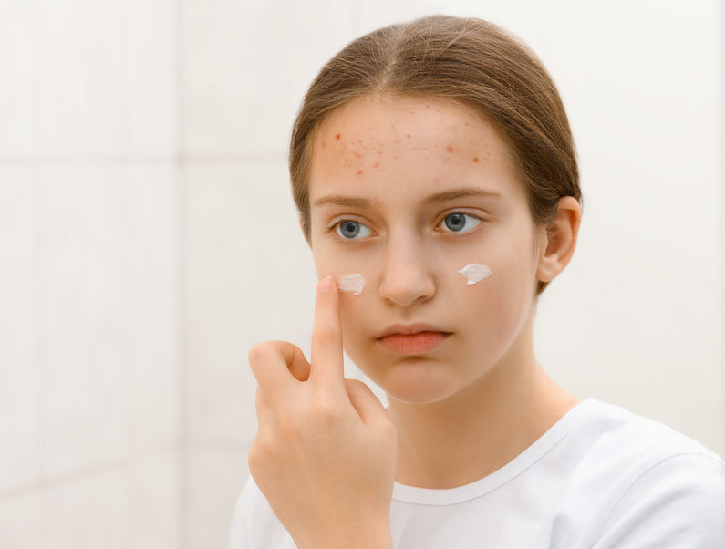 Teen troubles: How to overcome skin issues | Network News