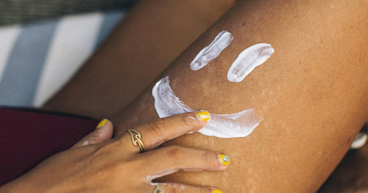 How to treat sunburned skin | Network News