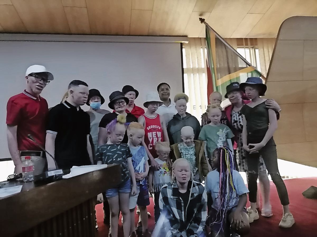Local albinism foundation appeals for assistance with sunscreen and ...