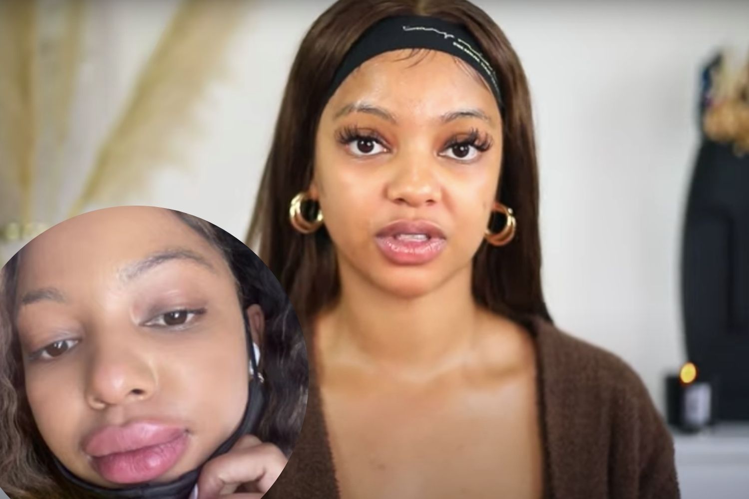 Mihlali Ndamase explains her lip filler disaster | The Citizen